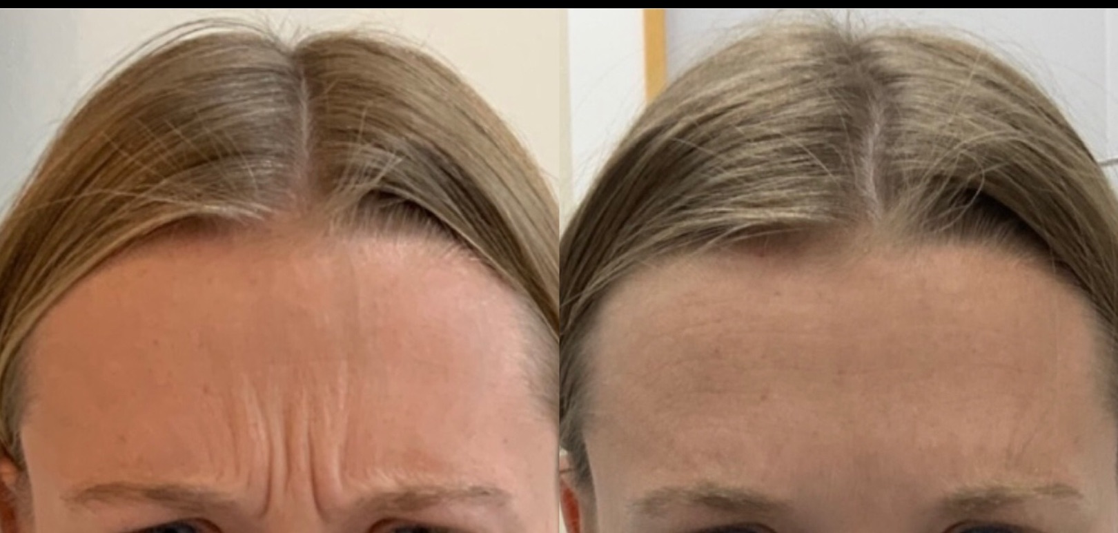 FAQ - Bella Medical Spa